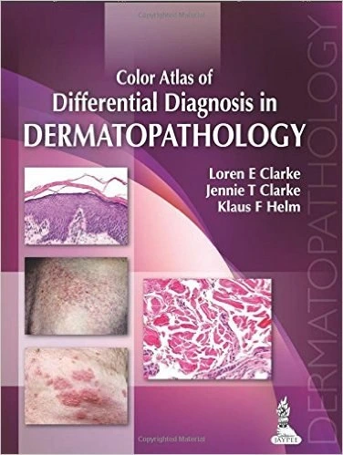 خرید و قیمت دانلود کتاب Color Atlas of Differential Diagnosis in Dermatopathology 1st Edition | ترب