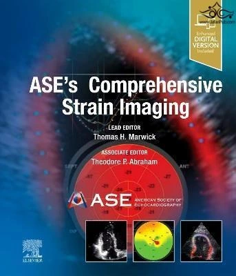 خرید و قیمت ASE's Comprehensive Strain Imaging2021 | ترب