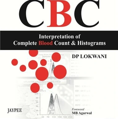 خرید و قیمت دانلود کتاب The ABC of CBC: Interpretation of Complete ...