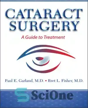 خرید و قیمت دانلود کتاب Cataract Surgery: A Guide to Treatment - جراحی ...
