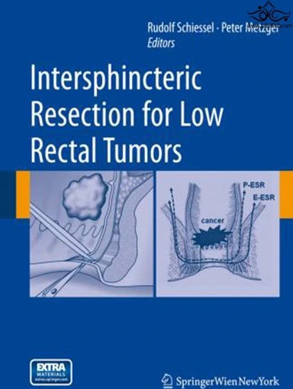خرید و قیمت کتاب Intersphincteric Resection for Low Rectal Tumors ...