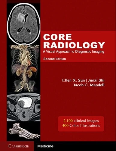 خرید و قیمت دانلود کتاب Core radiology : A Visual Approach To ...