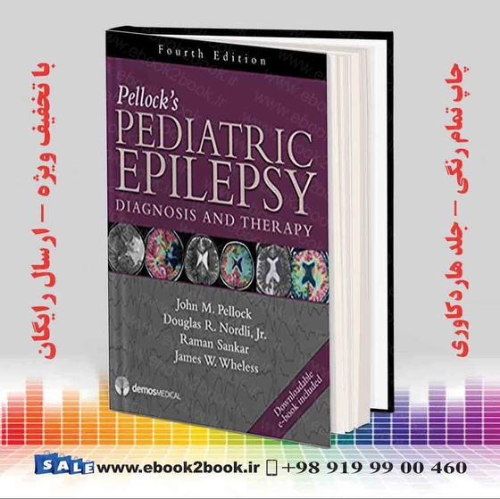 خرید و قیمت Pellock’s Pediatric Epilepsy, 4th Edition2016 | ترب