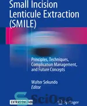 خرید و قیمت دانلود کتاب Small Incision Lenticule Extraction (SMILE ...