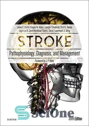خرید و قیمت دانلود کتاب Stroke: Pathophysiology, Diagnosis, and ...