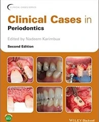 خرید و قیمت کتاب Clinical Cases in Periodontics (Clinical Cases ...