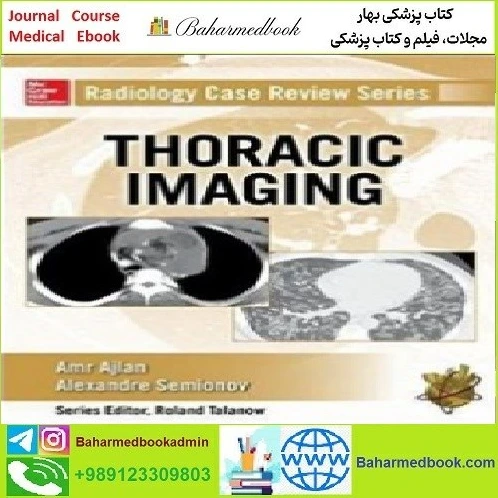 خرید و قیمت Radiology Case Review Series Thoracic Imaging TRUE PDF price 1€ | ترب