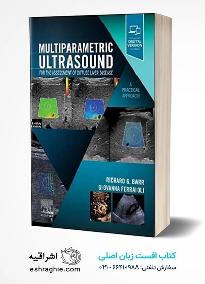 خرید و قیمت Multiparametric Ultrasound For The Assessment Of Diffuse
