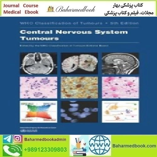 خرید و قیمت Central Nervous System Tumours WHO Classification of Tumours 2022 TRUE PDF price 1 ...