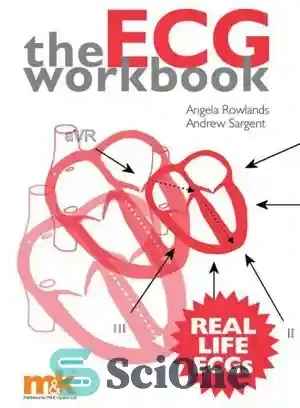 خرید و قیمت دانلود کتاب The ECG Workbook - کتاب کار ECG | ترب
