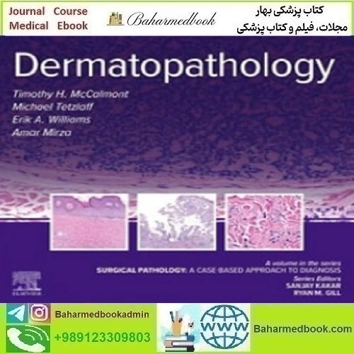 خرید و قیمت Dermatopathology Surgical Pathology A Case-Based Approach to Diagnosis 2026 TRUE PDF ...