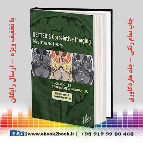 خرید و قیمت Netter’s Correlative Imaging: Neuroanatomy | ترب