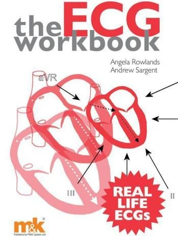 خرید و قیمت دانلود کتاب The ECG Workbook | ترب