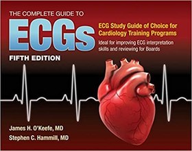 خرید و قیمت کتاب The Complete Guide to ECGs: A Comprehensive Study Guide to Improve ECG ...