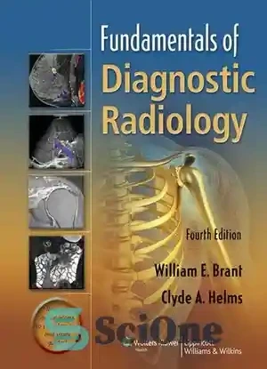 خرید و قیمت دانلود کتاب Fundamentals of Diagnostic Radiology - مبانی رادیولوژی تشخیصی | ترب