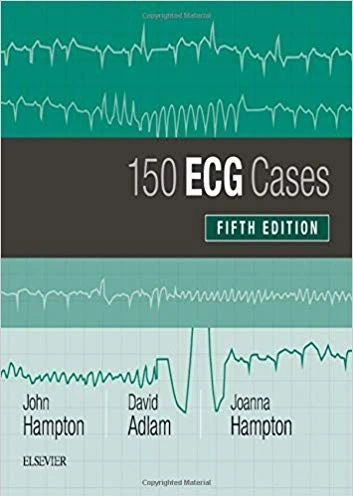 خرید و قیمت ECG Cases (150 ECG Problems) 2019 – الکتروکاردیوگرام | ترب