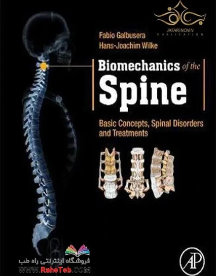 خرید و قیمت Biomechanics of the Spine: Basic Concepts, Spinal Disorders ...