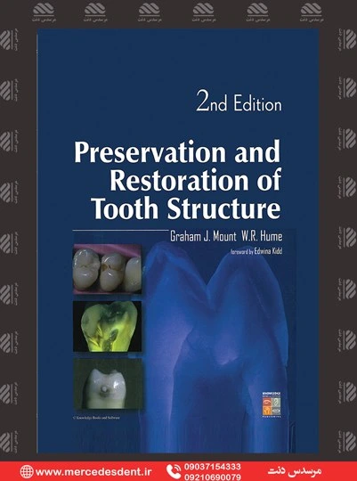 خرید و قیمت Preservation and Restoration of Tooth Structure | ترب