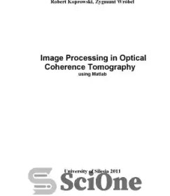 خرید و قیمت دانلود کتاب Image processing in optical coherence tomography using Matlab - پردازش ...