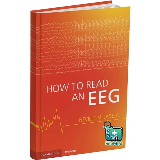 خرید و قیمت کتاب How to Read an EEG 1st Edition | ترب