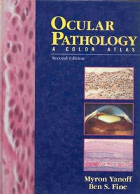 خرید و قیمت دانلود کتاب Ocular pathology : a color atlas ویرایش 2 | ترب