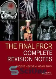 خرید و قیمت دانلود کتاب The Final FRCR: Complete Revision Notes - FRCR ...