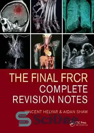 خرید و قیمت دانلود کتاب The Final FRCR: Complete Revision Notes - FRCR ...