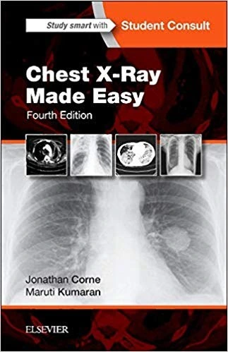 خرید و قیمت دانلود کتاب Chest X-Ray Made Easy (4th Edition) | ترب