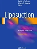 خرید و قیمت کتاب لیپوساکشن Liposuction : Principles and Practice | ترب