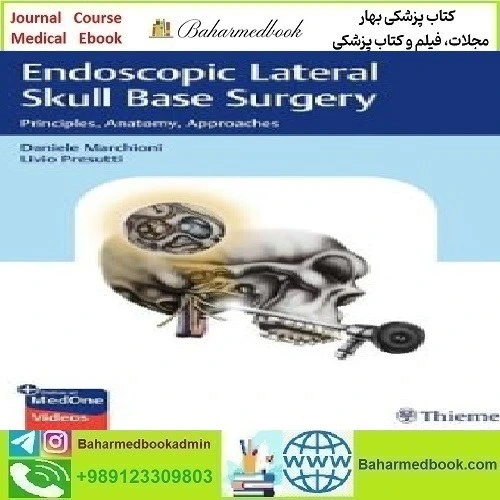 خرید و قیمت Endoscopic Lateral Skull Base Surgery Principles Anatomy Approaches 2022 TRUE PDF ...