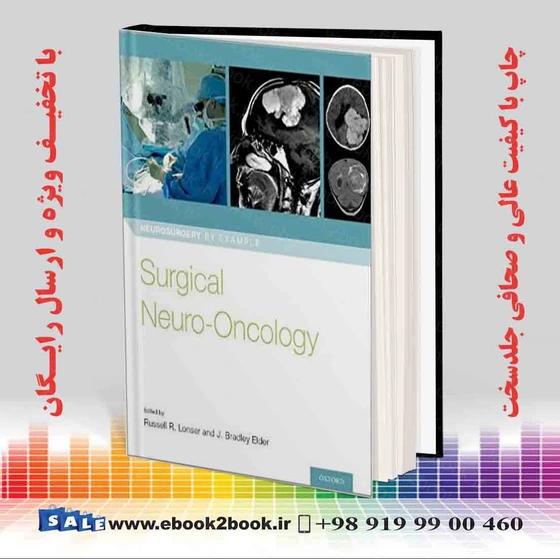 خرید و قیمت Surgical Neuro-Oncology (Neurosurgery by Example) 1st Edition | ترب