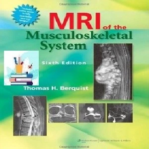 خرید و قیمت MRI of the Musculoskeletal System TRUE PDF price 1€ | ترب