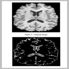 خرید و قیمت GAUSSIAN KERNEL BASED FUZZY C-MEANS CLUSTERING ALGORITHM ...