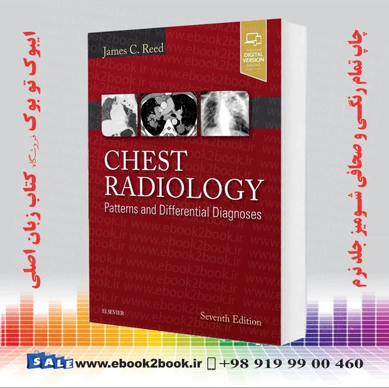 خرید و قیمت Chest Radiology : Patterns and Differential Diagnoses ...