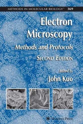 خرید و قیمت دانلود کتاب Electron Microscopy: Methods and Protocols 2nd | ترب