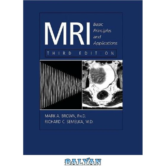 خرید و قیمت دانلود کتاب MRI Basic Principles and Applications | ترب