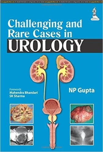 خرید و قیمت دانلود کتاب Challenging and Rare Cases in Urology 1st Edition | ترب