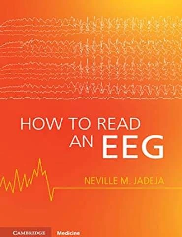 خرید و قیمت دانلود کتاب How to Read an EEG 1st Edition | ترب