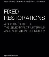 خرید و قیمت کتاب Fixed Restorations : A Clinical Guide to the Selection ...
