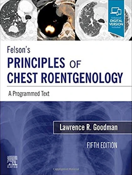 خرید و قیمت Felson's Principles of Chest Roentgenology, A Programmed ...