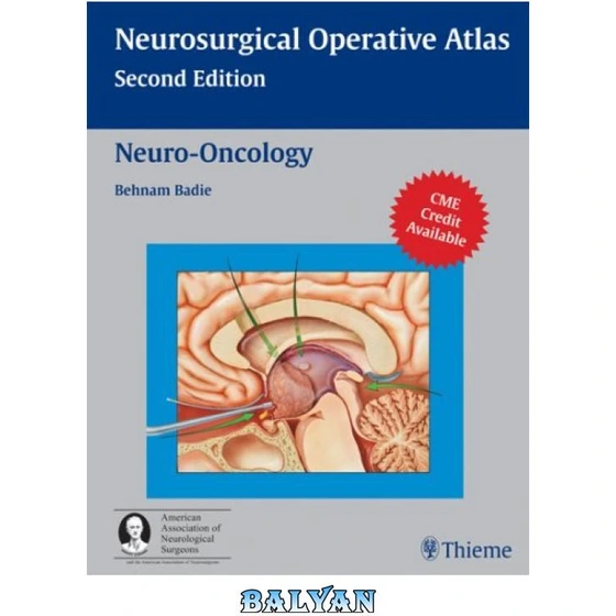 خرید و قیمت دانلود کتاب Neuro-Oncology - Neurosurgical Operative Atlas ...