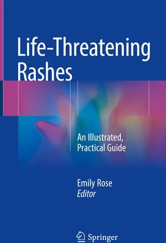 خرید و قیمت دانلود کتاب Life-Threatening Rashes: An Illustrated ...