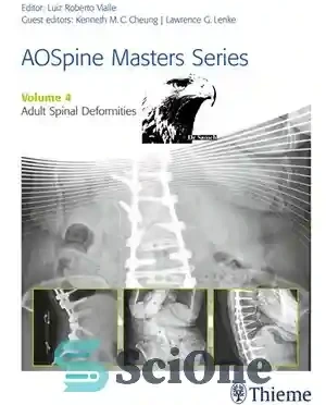 خرید و قیمت دانلود کتاب Aospine Masters Series, Volume 4: Adult Spinal ...
