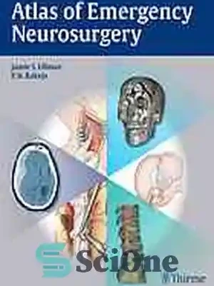 خرید و قیمت دانلود کتاب Atlas of emergency neurosurgery - اطلس جراحی مغز و اعصاب اضطراری | ترب